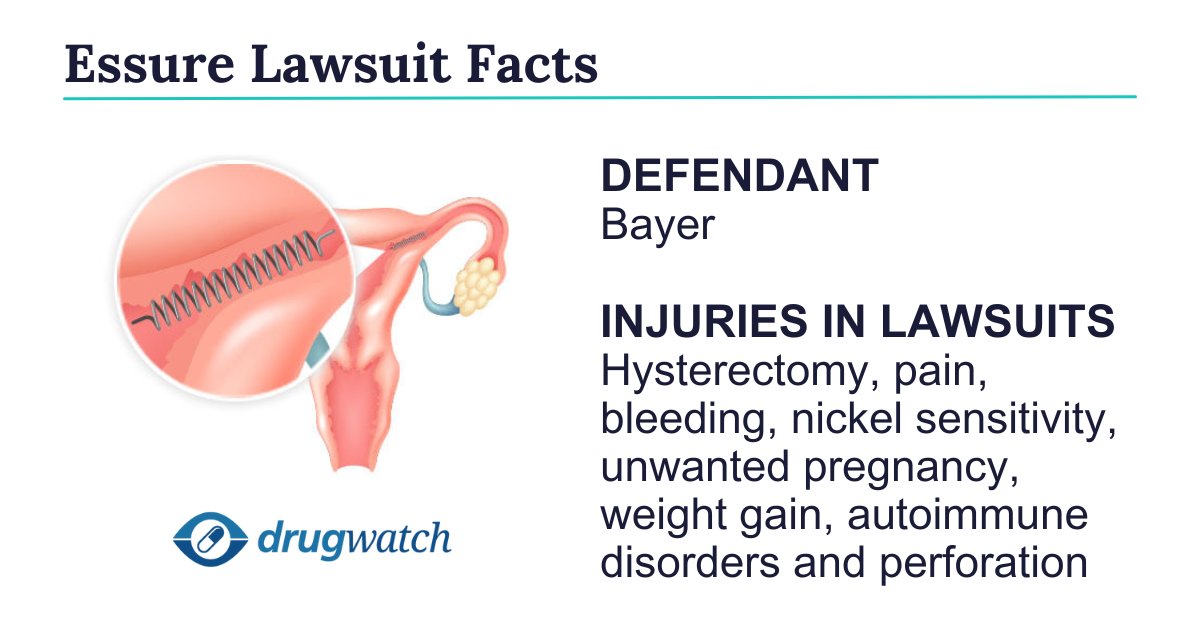 Essure Lawsuits | Birth Control Lawsuit Settlement Amounts