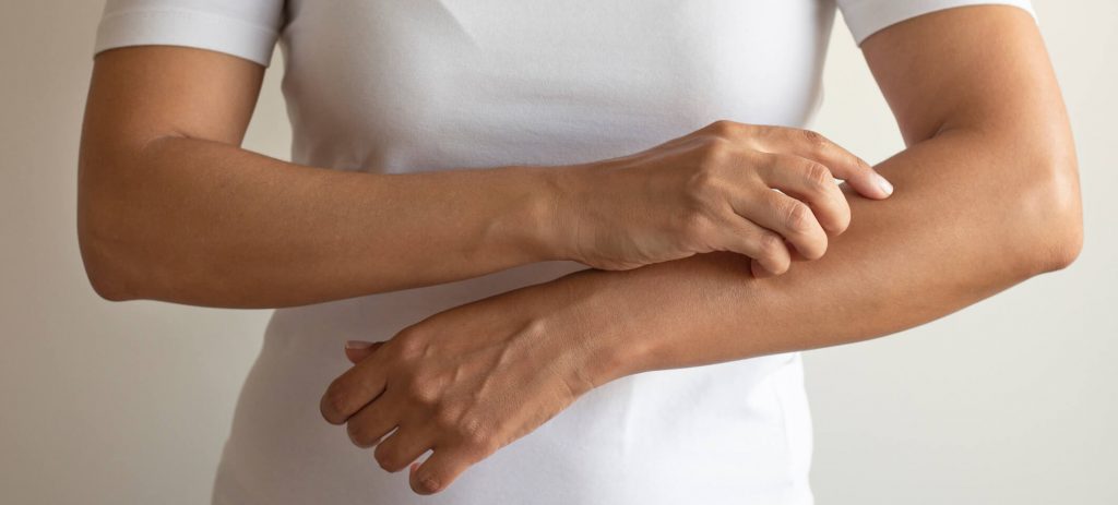 Skin Rashes & Conditions | Types & When to Worry