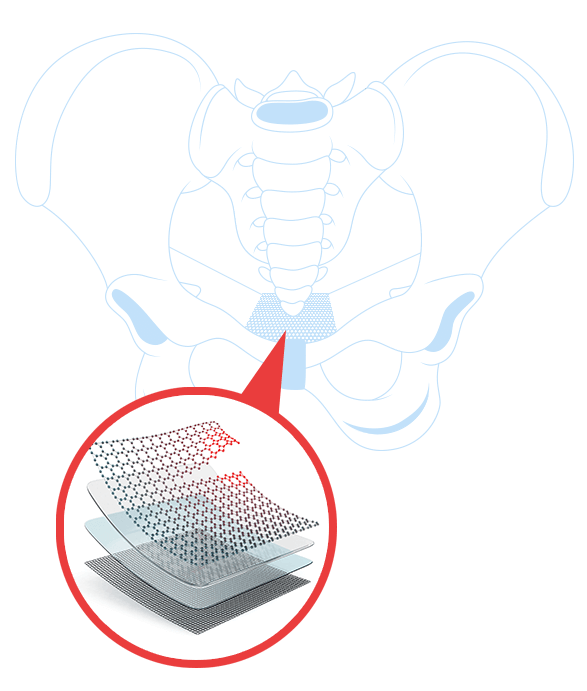 Transvaginal Mesh | What Is Transvaginal Mesh Used For?