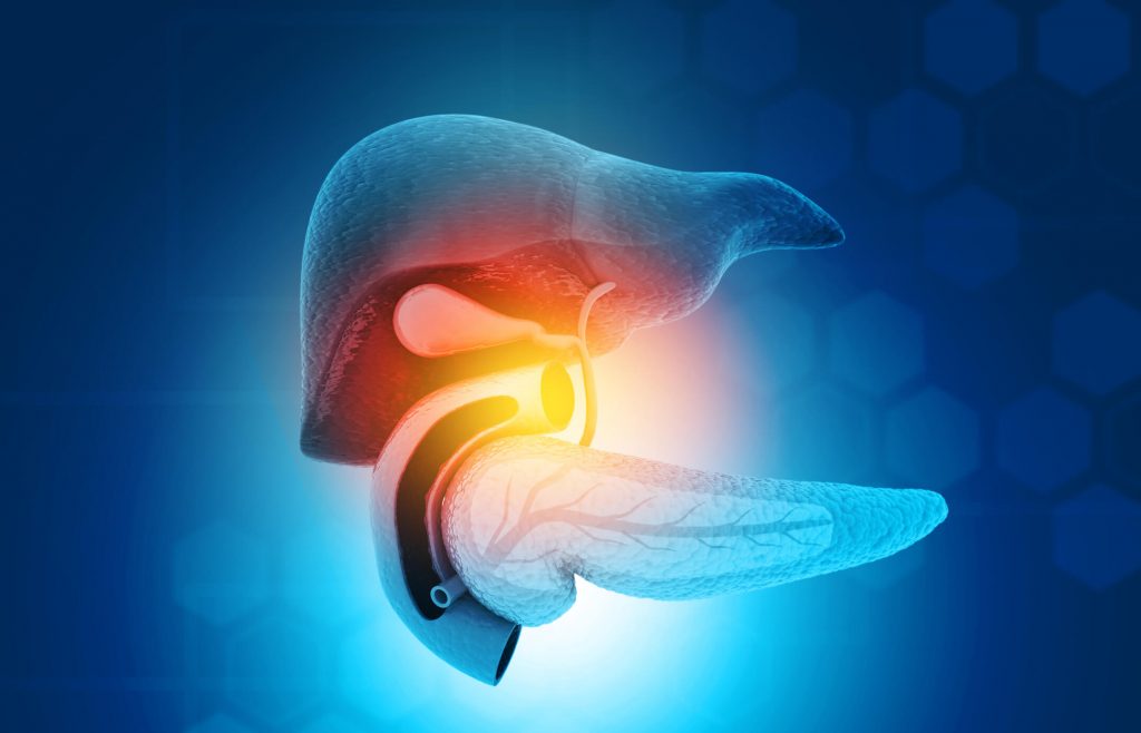 Pancreatic Cancer | Symptoms, Causes, Types, Stages and Treatment