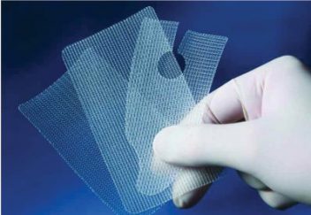 Physicians Expect Surgical Mesh Use to Grow in 2012