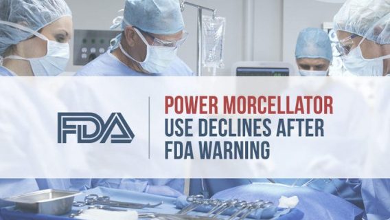 FDA Approves New Power Morcellator Amid Cancer Concerns
